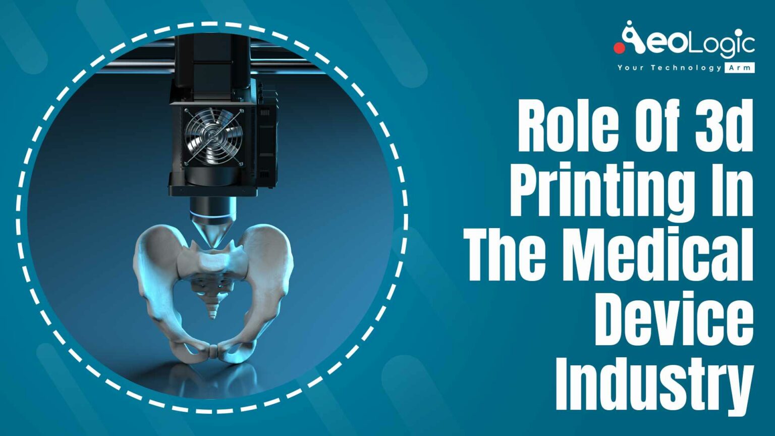 Role Of 3d Printing In The Medical Device Industry Aeologic Blog